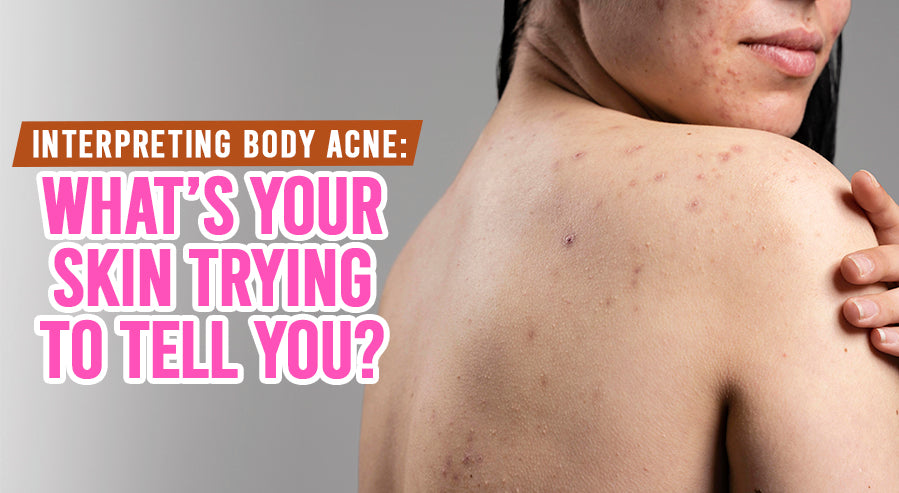 Interpreting Body Acne: What's Your Skin Trying to Tell You?
