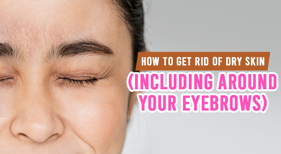 [Guide] How to Get Rid of Dry Skin (Including Around Your Eyebrows)