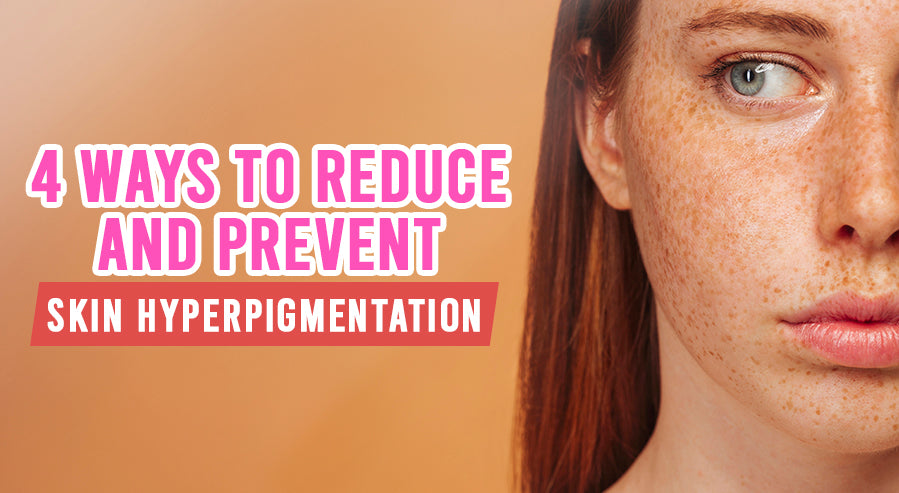 4 Ways to Reduce and Prevent Skin Hyperpigmentation