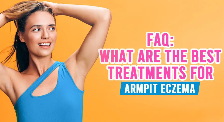 FAQ: What Are The Best Treatments for Armpit Eczema?