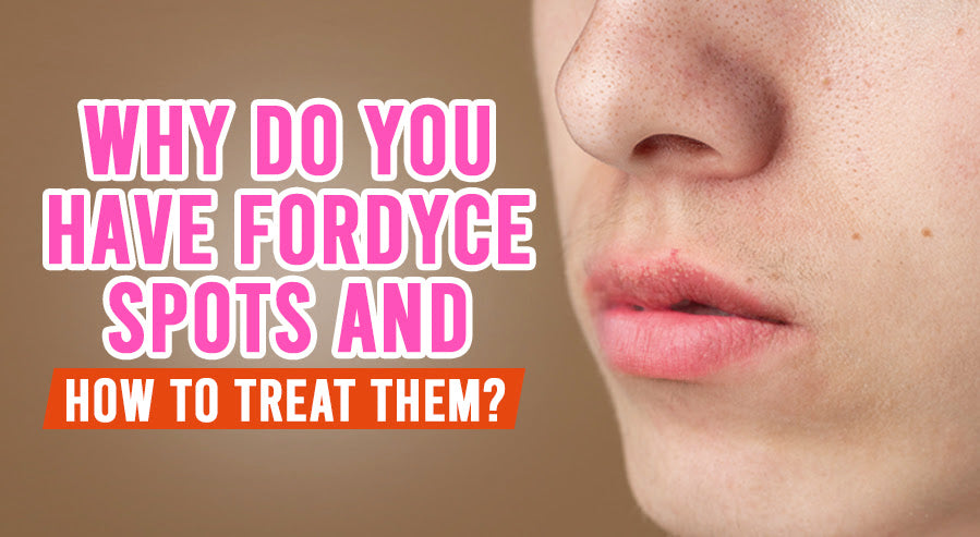 Why Do You Have Fordyce Spots and How to Treat Them?
