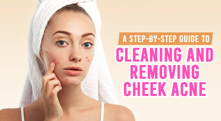 A Step-By-Step Guide to Cleaning and Removing Cheek Acne